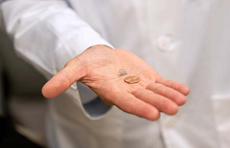 Zephyr® Valve | Northwestern Medicine